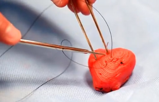 5 Innovative 3D-Printed Medical Devices in 2019 | SolidProfessor